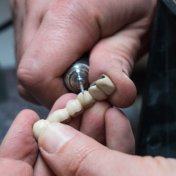 Types of Implant Prostheses